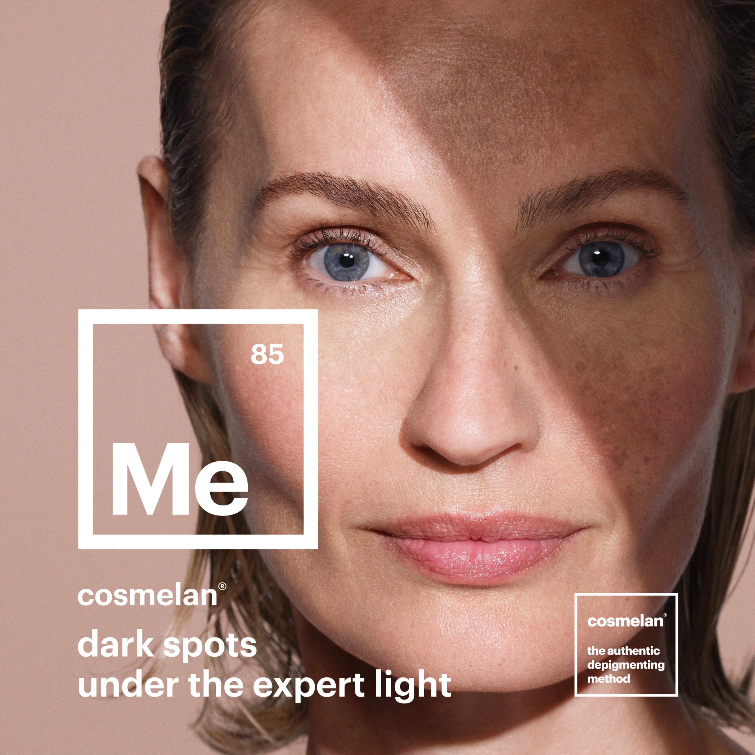 Cosmelan Depigmentation Method - Revive Skin and Laser